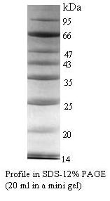 Mid-Range Protein Marker: 14-95 kDa | CymitQuimica